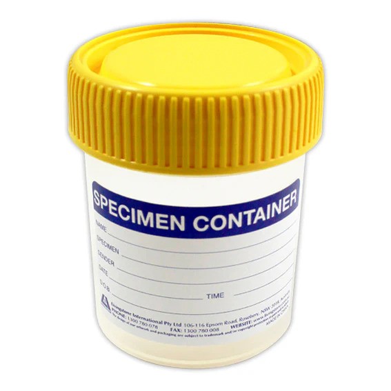 STERILE SPECIMEN JAR 70ML LABELLED YELLOW CAP 7593 - Pack of 10 | Diagmed